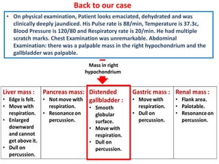 Obstructive jaundice | PPTX