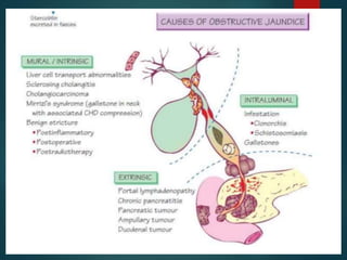 obstructivejaundice-190919140942.pdf