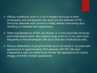 Imaging of Obstructive jaundice | PPTX