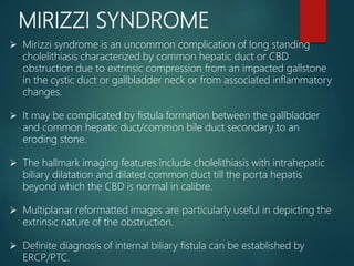 Imaging of Obstructive jaundice | PPTX