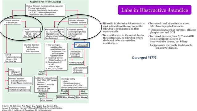 obstructive jaundice.pptx