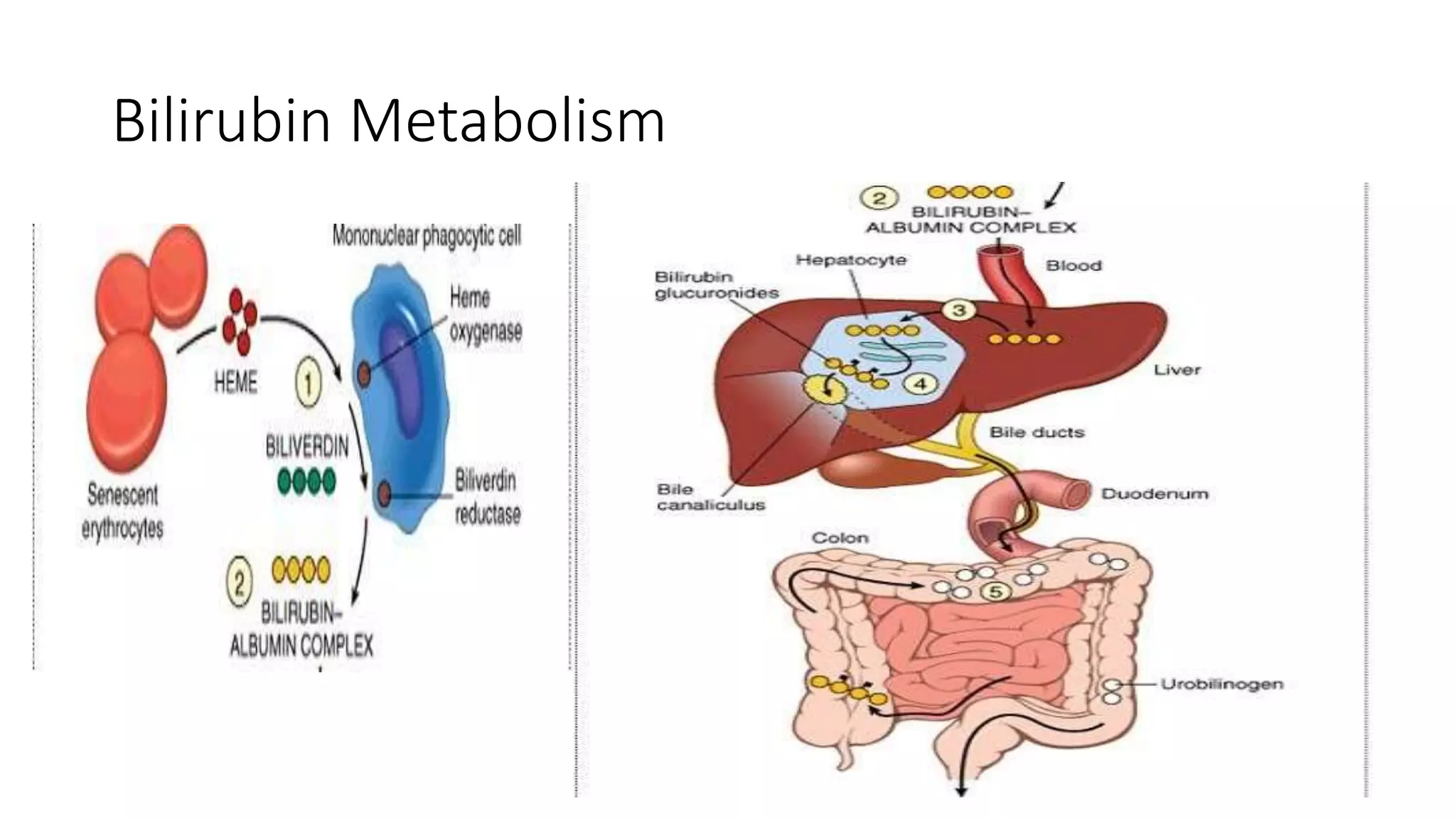 obstructive_jaundice.pptx