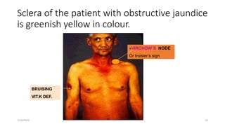 Obstructive jaundice.pptx