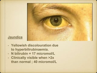 obstructive jaundic1312131321232131e.pptx
