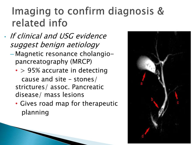 Obstructive Jaundice- General Surgery notes | PPT