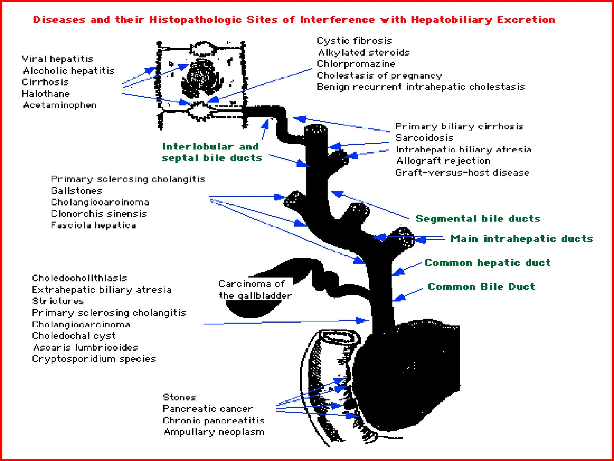 Causes of obstructive jaundice in surgical patients | PPT
