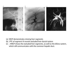Causes of obstructive jaundice in surgical patients | PPTX