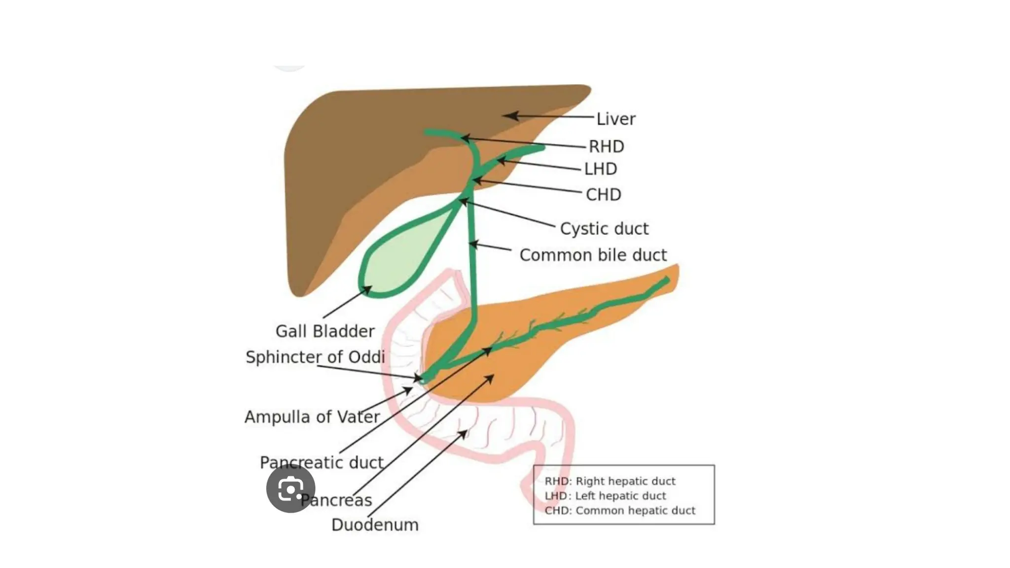Obstructive jaundice or post hepatic jaundice | PPTX