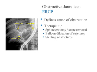 Obstructive Jaundice, causes, investigations.ppt
