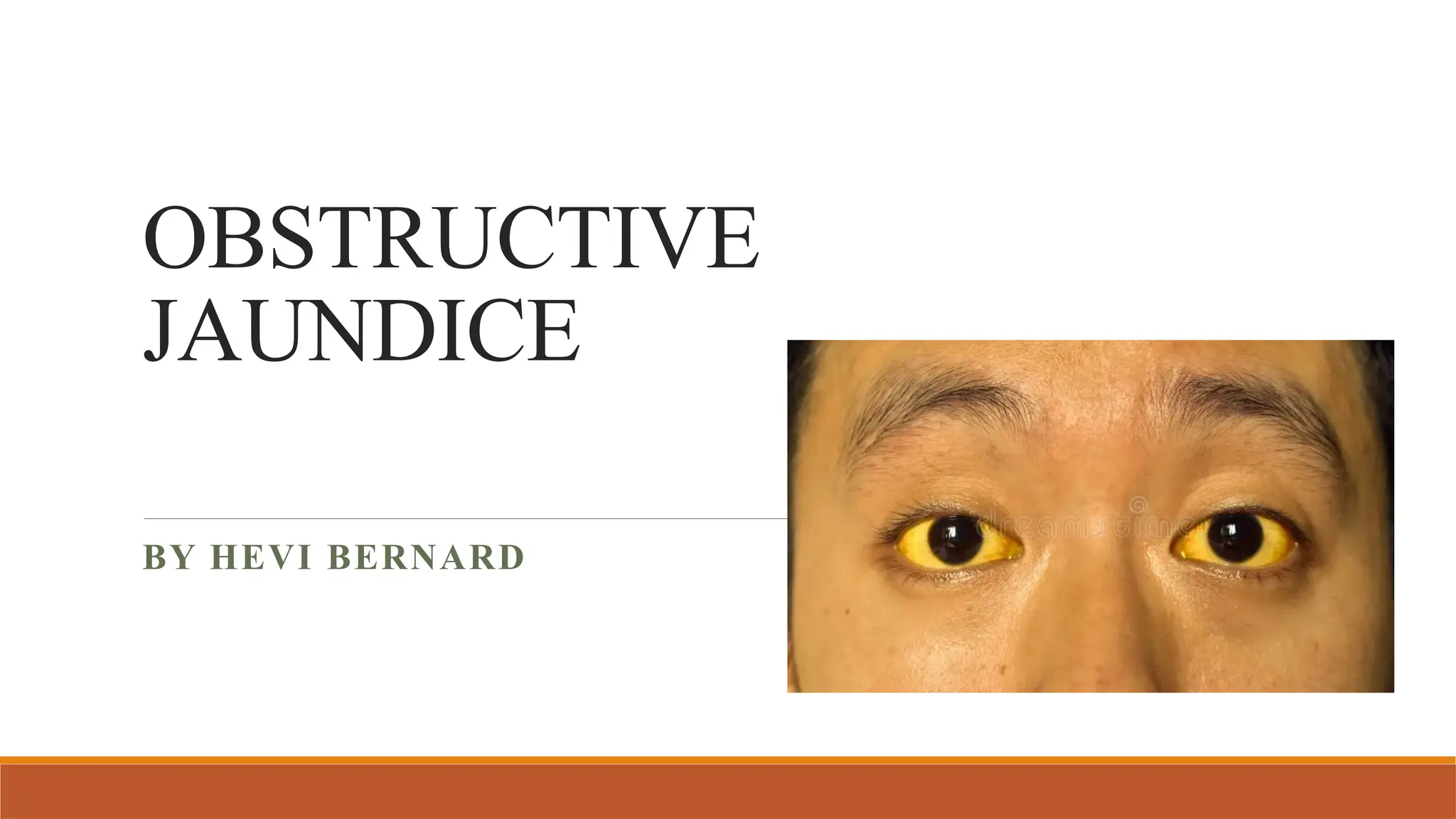 OBSTRUCTIVE JAUNDICE , causes, classification.pptx