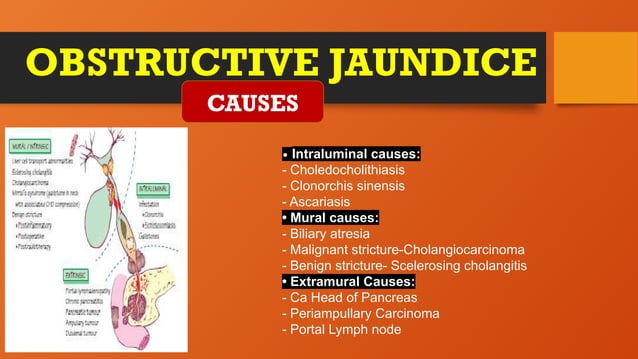 OBSTRUCTIVE JAUNDICE- Problem Oriented Approach.pptx