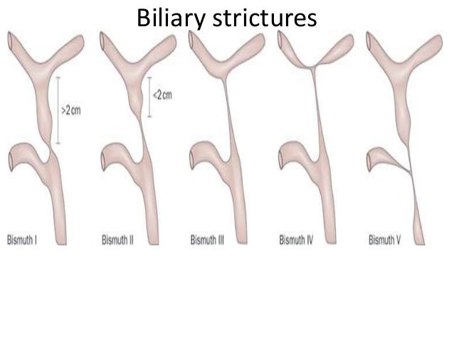 Obstructive jaundice: concerned investigations