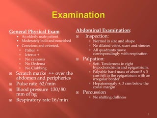 Obstructive jaundice (final year mbbs lecture ) | PPTX