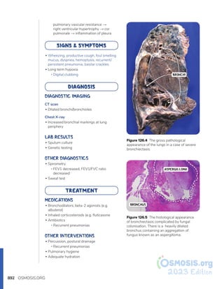 Obstructive lung disease Notes_ Osmosis | PDF