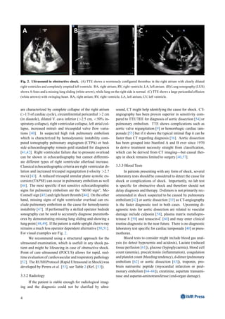 Obstructive Shock, from Diagnosis to Treatment.pdf