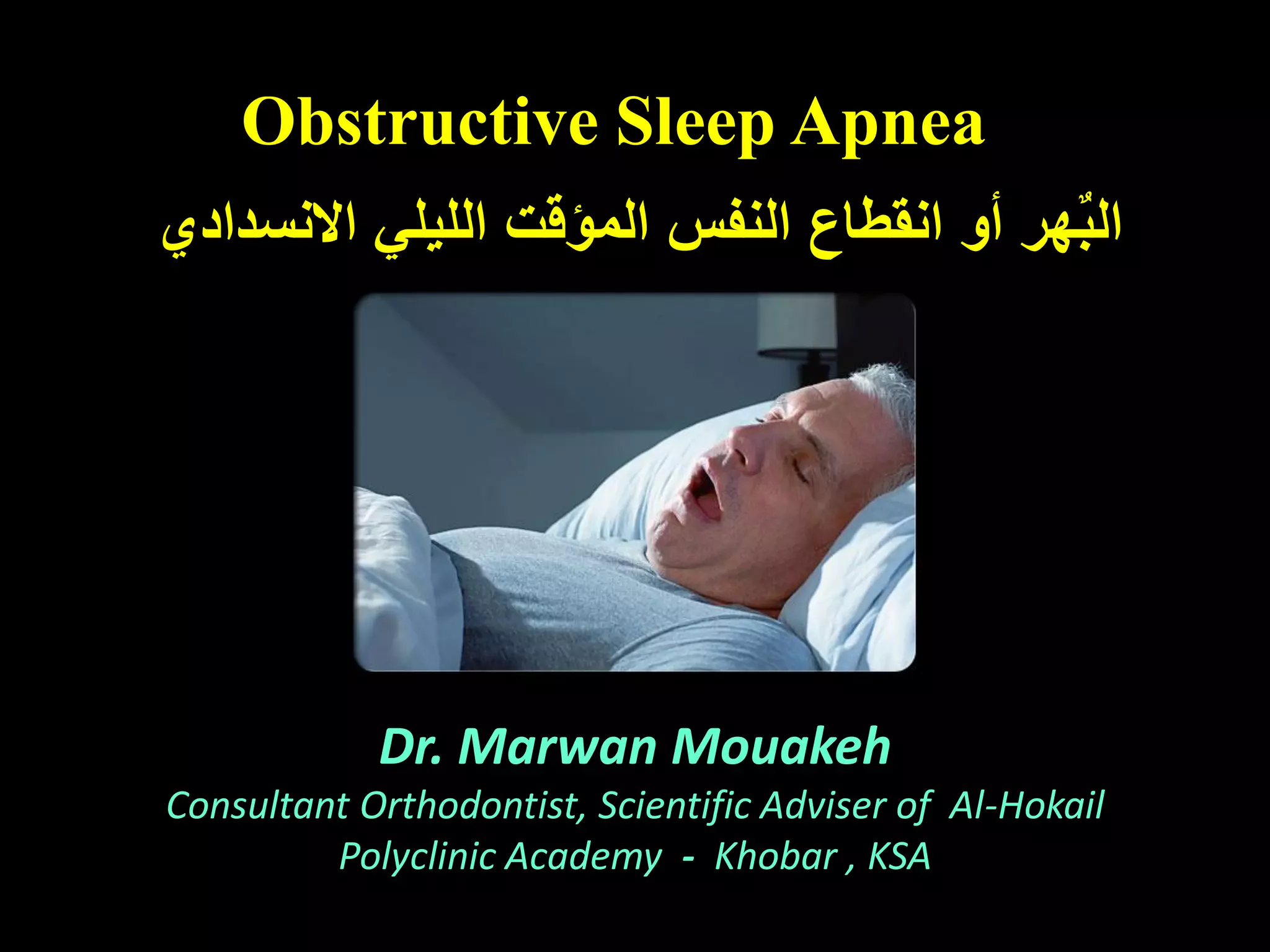 Obstructive sleep apnea | PDF