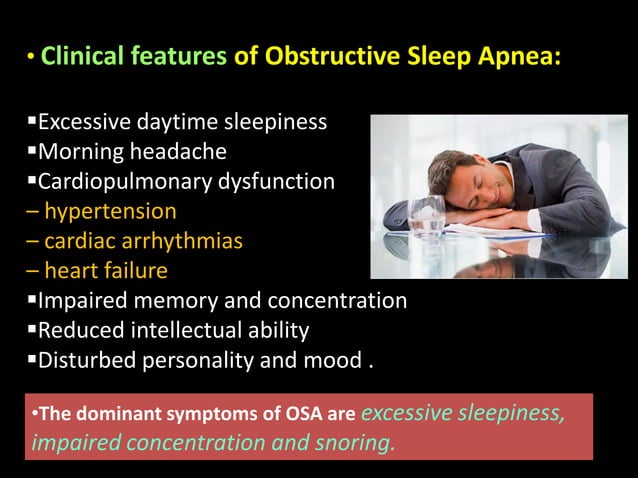 Obstructive sleep apnea | PDF