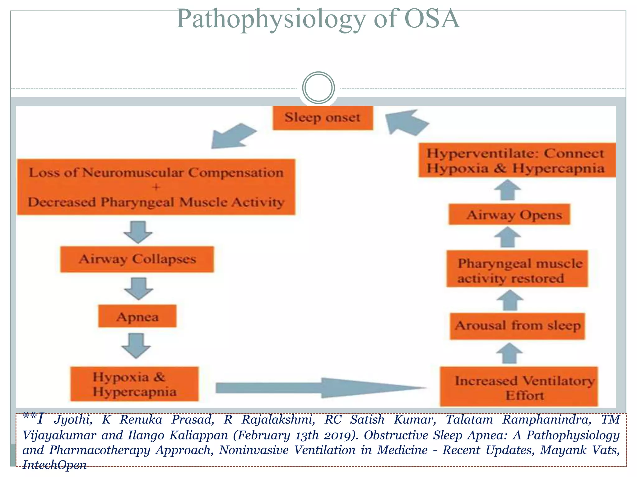 Obstructive sleep apnea | PPTX