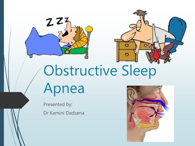 Obstructive sleep apnea | PPTX