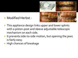 OBSTRUCTIVE SLEEP APNEA.ppt