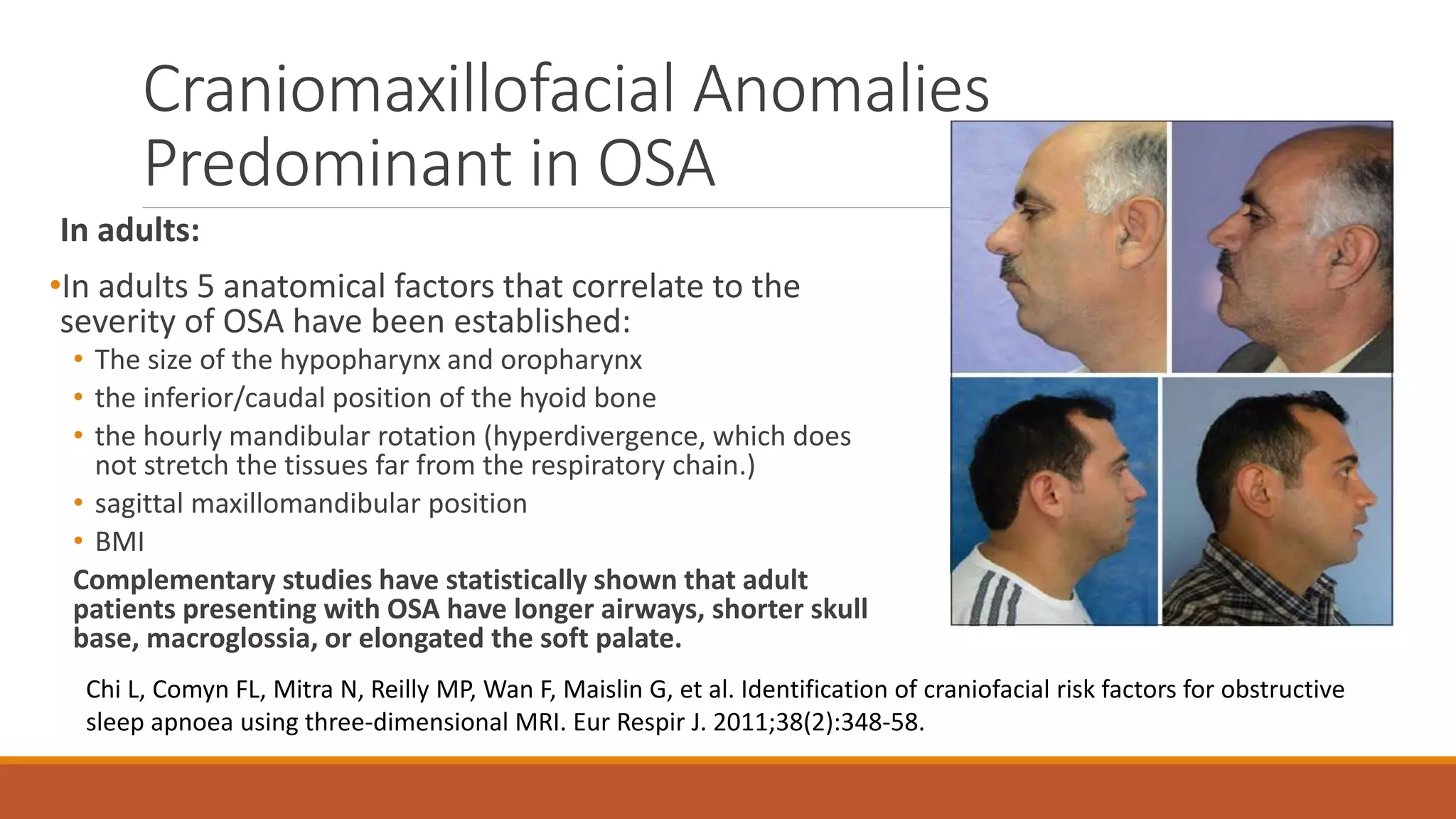 Obstructive Sleep Apnea And Orthognathic Surgery.pptx | Ear, Nose and ...