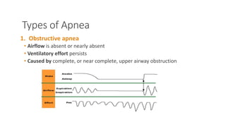 Obstructive Sleep Apnea And Orthognathic Surgery.pptx