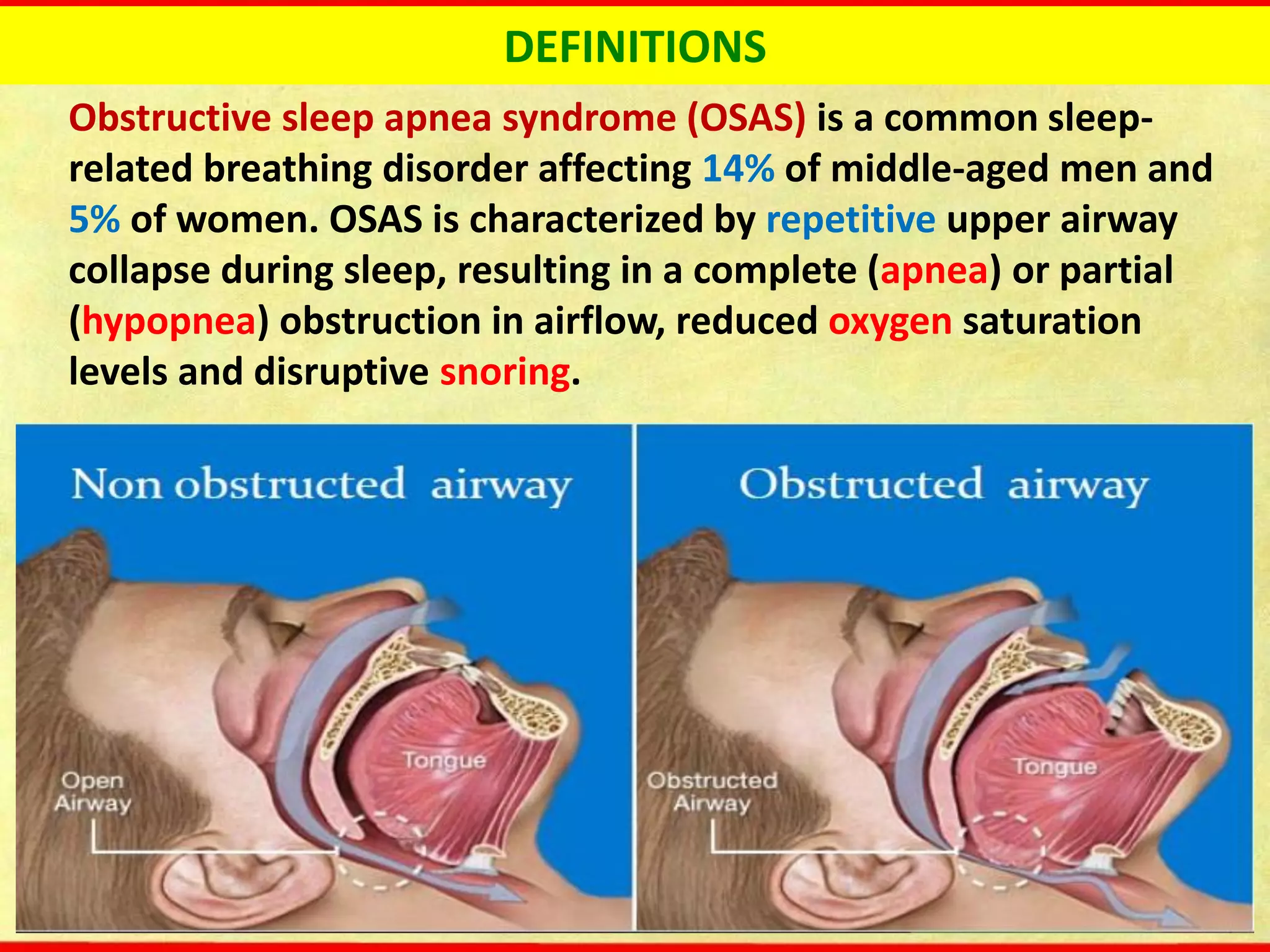 Obstructive sleep apnea syndrome.pdf