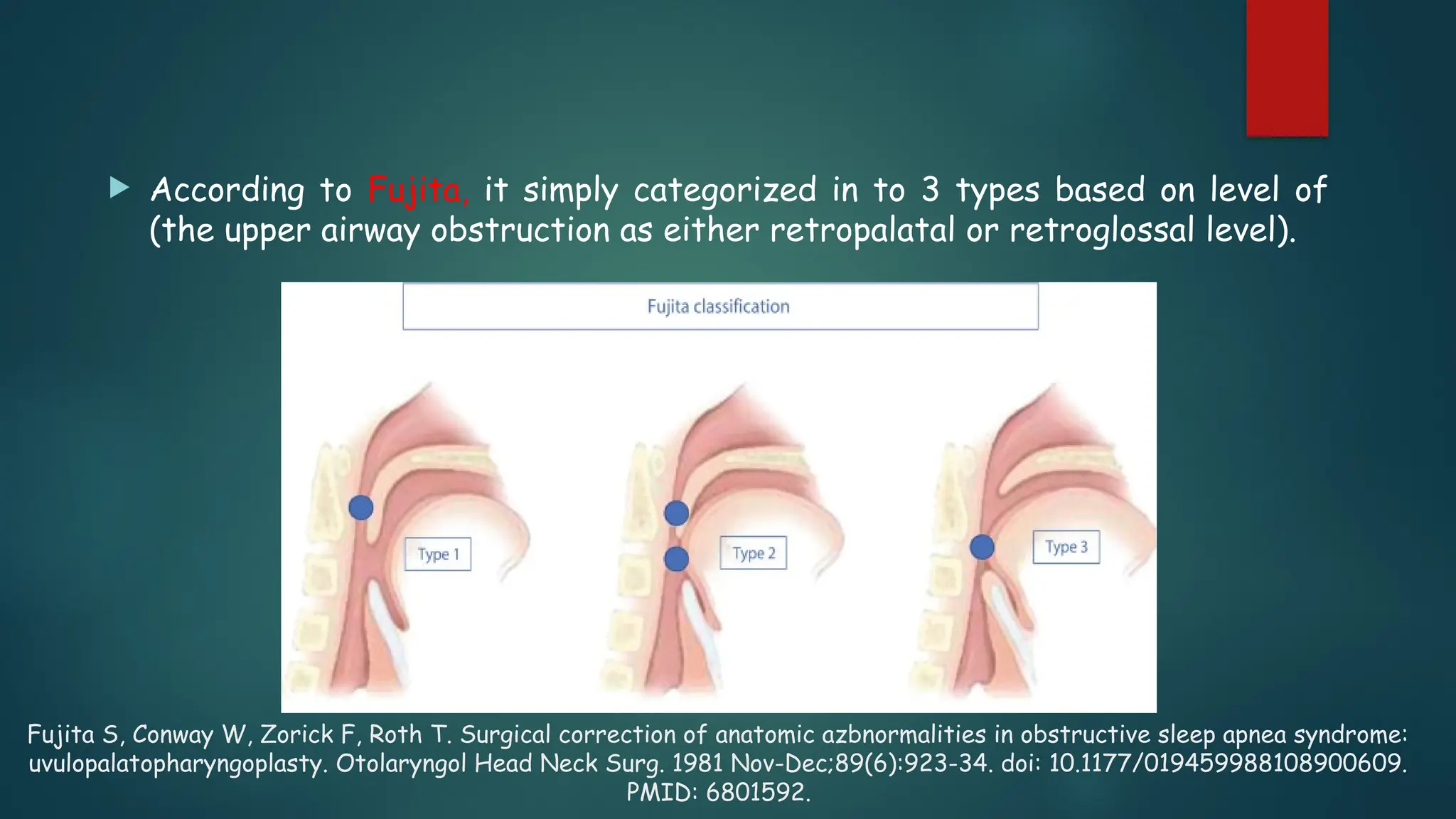 OBSTRUCTIVE SLEEP APNOEA in orthodontics | PPTX