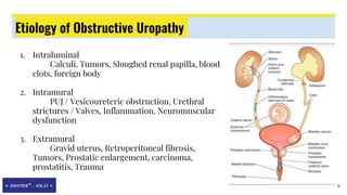 Obstructive Uropathy | PPTX