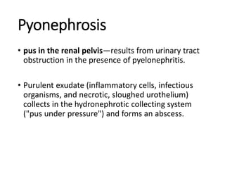Obstructive uropathy-1.pptx
