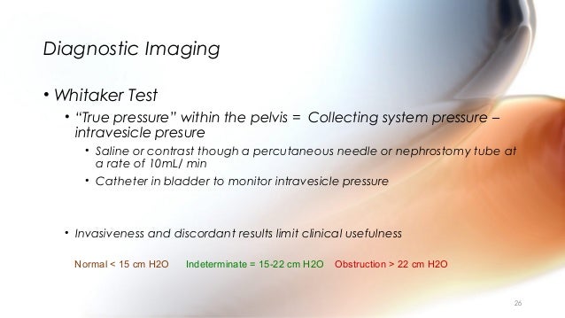 Obstructive uropathy