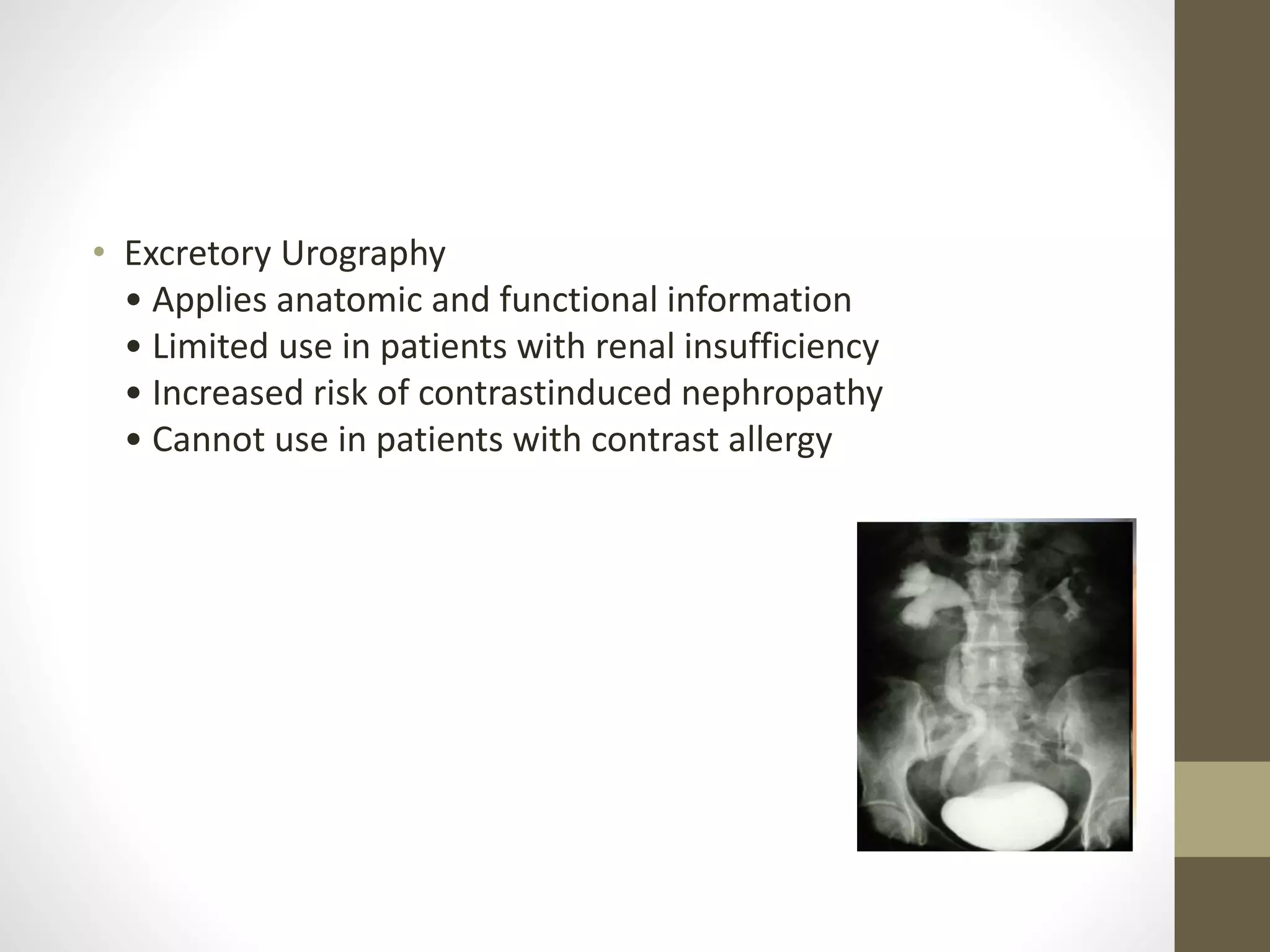 Obstructive Uropathy.pptx