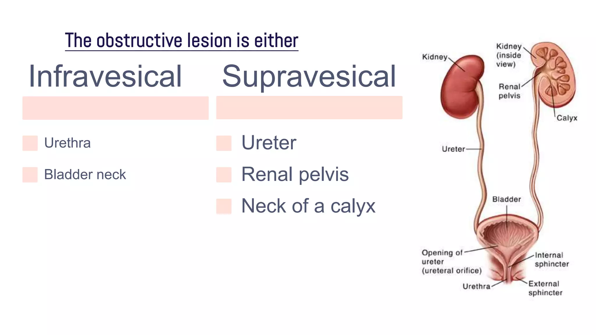 obstructive uropathy.pptx