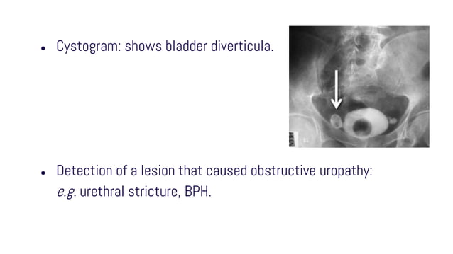obstructive uropathy.pptx | Digestive Disorders | Diseases and Conditions