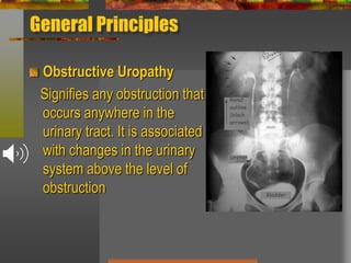 Obstructive Uropathy "online" | PPTX