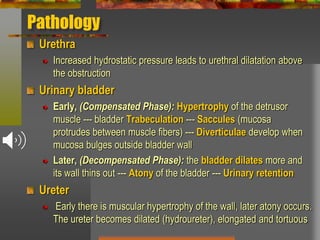 Obstructive Uropathy "online" | PPTX