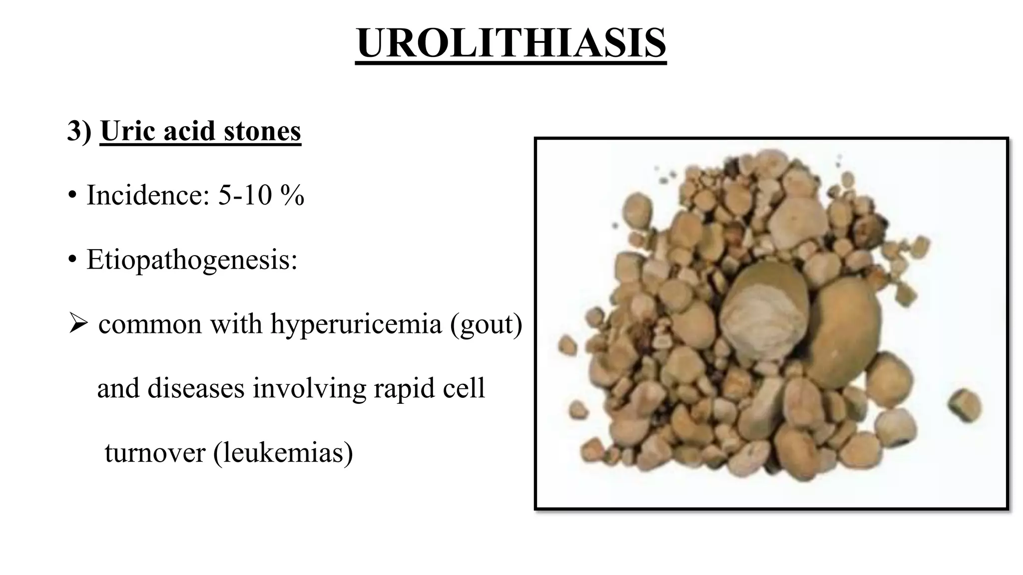 OBSTRUCTIVE UROPATHY PPT.pptx