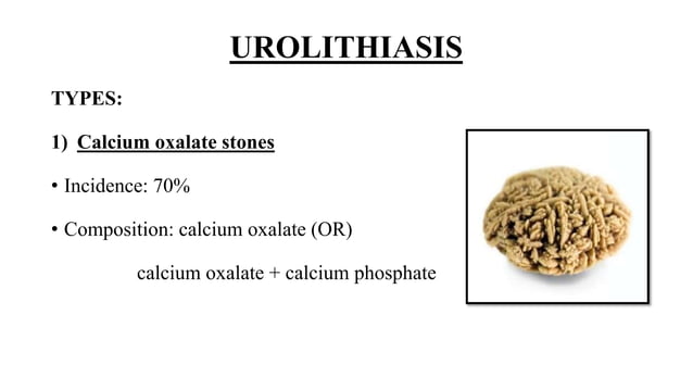 Obstructive Uropathy Ppt Pptx