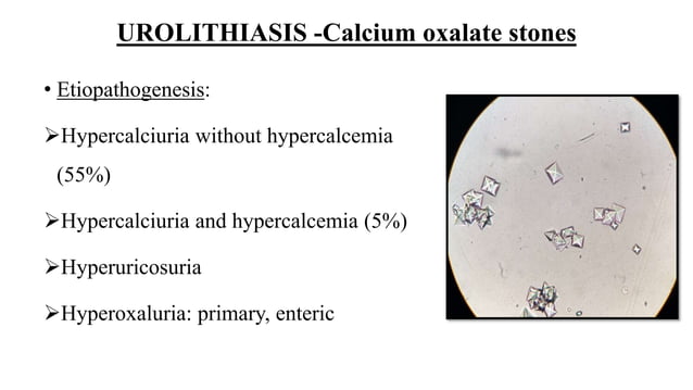 OBSTRUCTIVE UROPATHY PPT.pptx