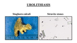 OBSTRUCTIVE UROPATHY PPT.pptx