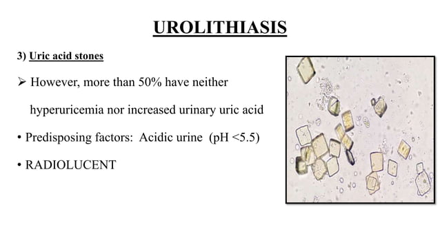 OBSTRUCTIVE UROPATHY PPT.pptx