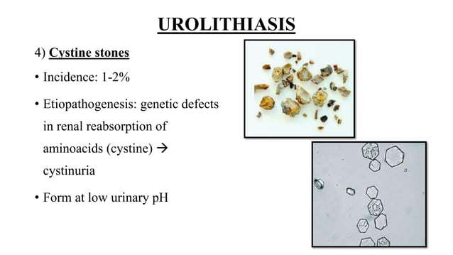 OBSTRUCTIVE UROPATHY PPT.pptx