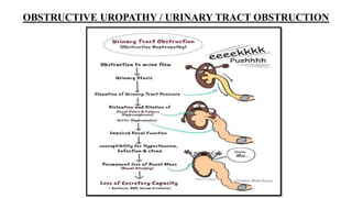 OBSTRUCTIVE UROPATHY PPT.pptx