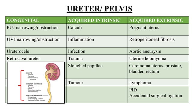 OBSTRUCTIVE UROPATHY PPT.pptx