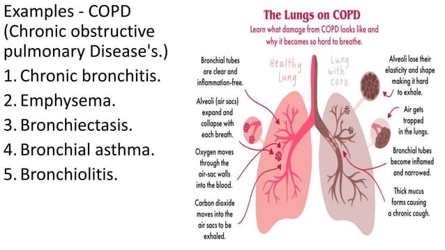 Obstructive vs Restructive lung Disease.pptx | Lung and Respiratory ...