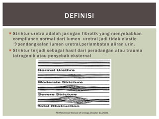 Obstruksi distal | PPTX