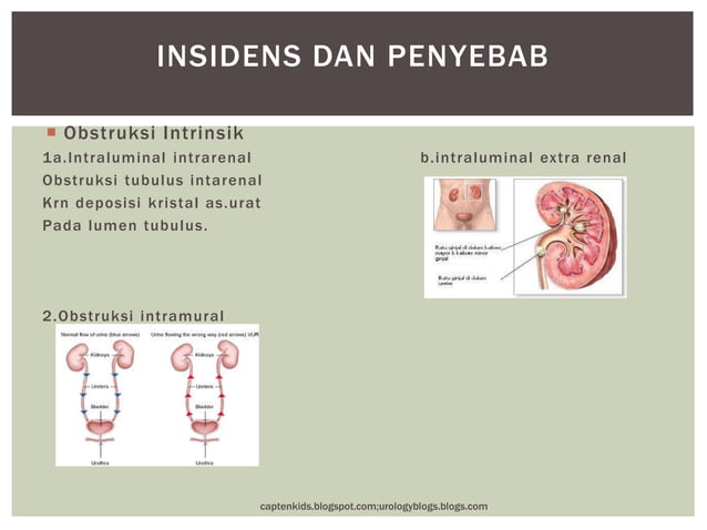 Obstruksi distal | PPT