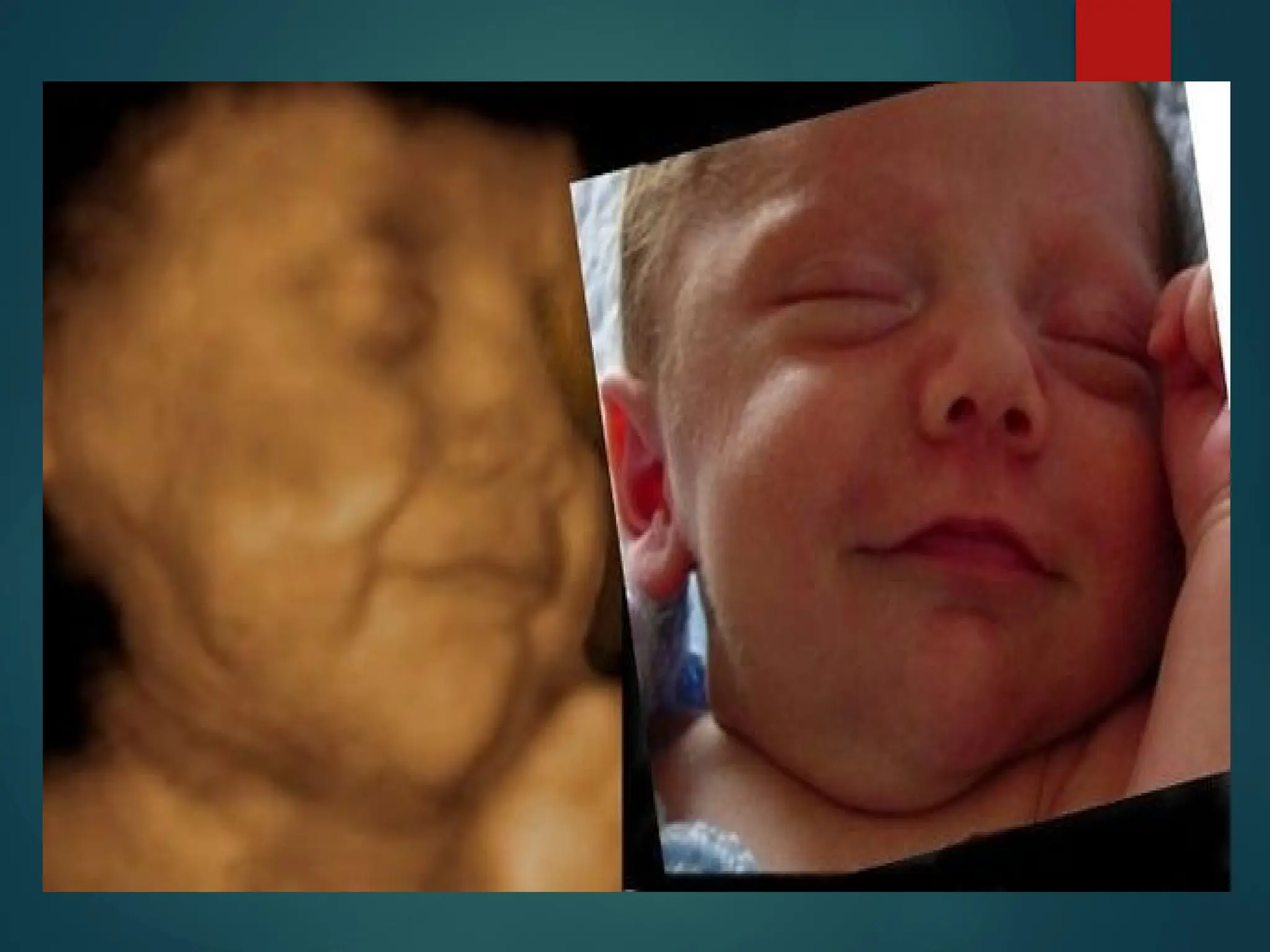 Obstetric ultrasound overview and first trimester.pptx