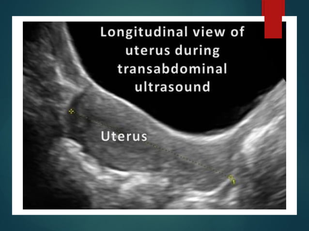 Obstetric ultrasound overview and first trimester.pptx