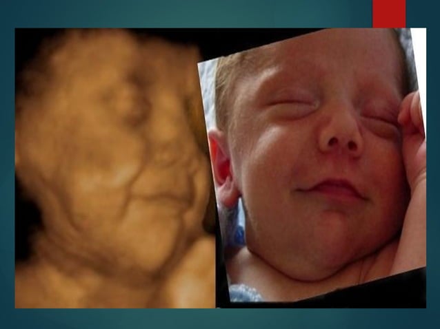Obstetric ultrasound overview and first trimester.pptx